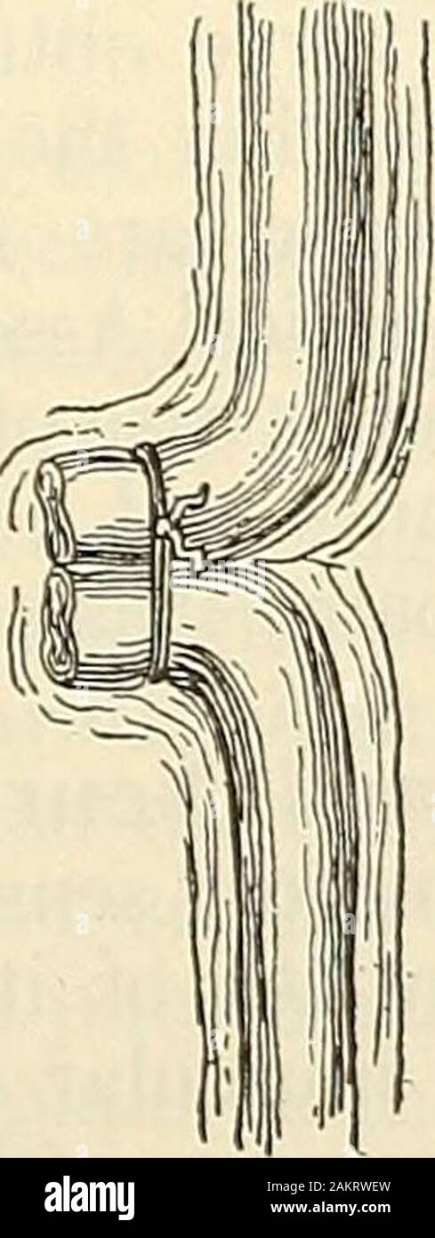 Modern surgery, general and operative Stock Photo - Alamy