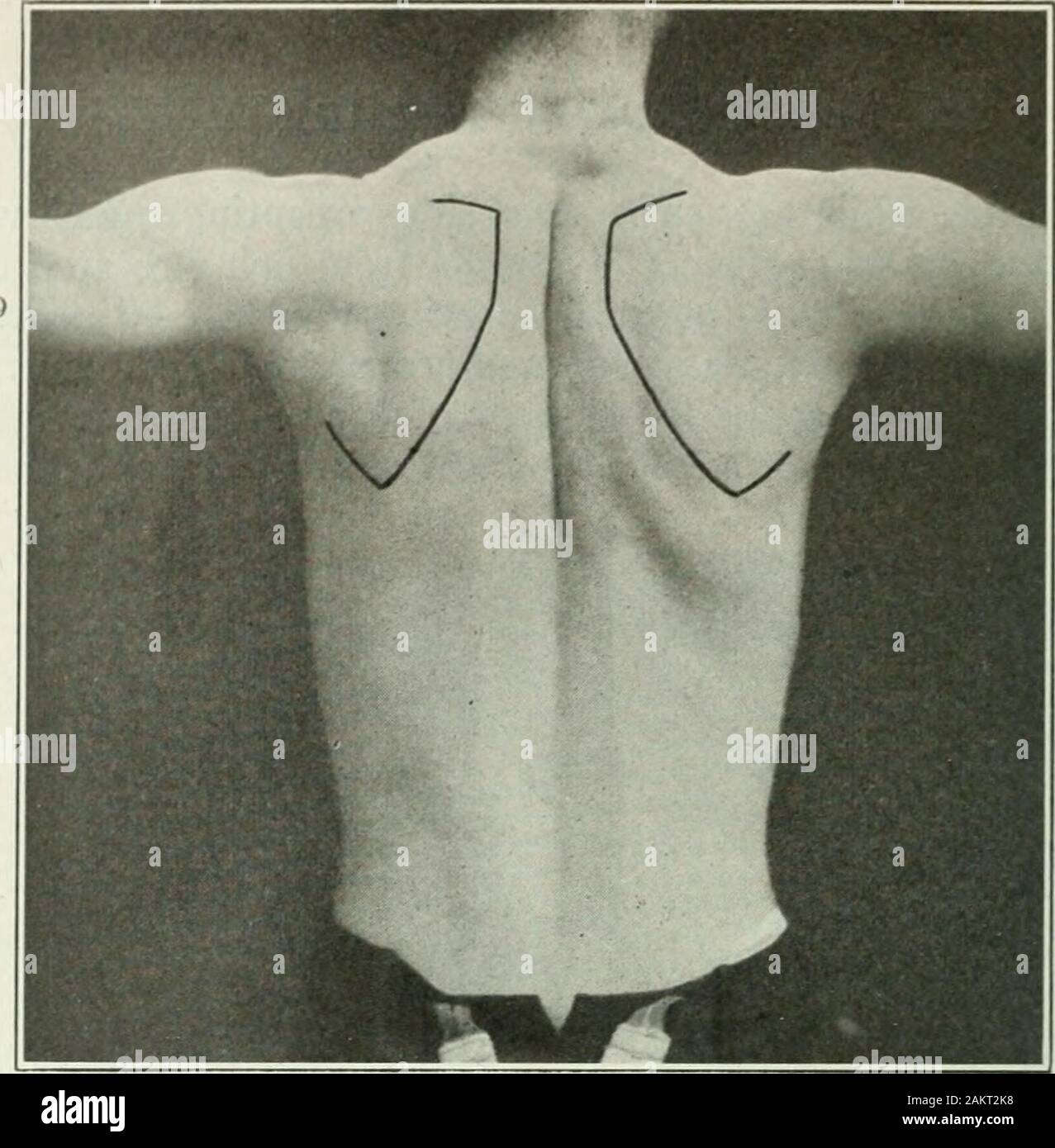 Applied anatomy and kinesiology; the mechanism of muscular movement ...