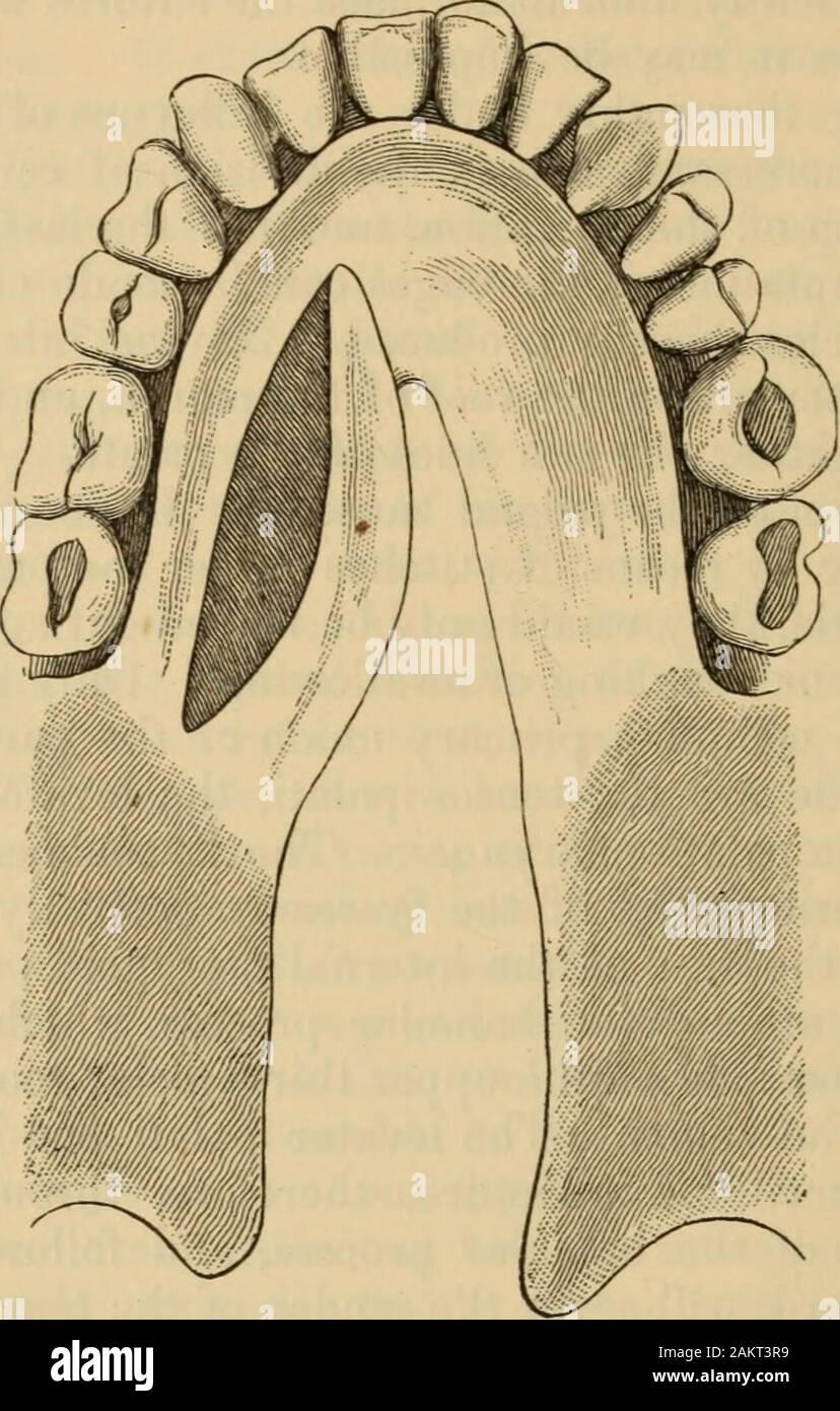 Anterior median fissure hi-res stock photography and images - Alamy