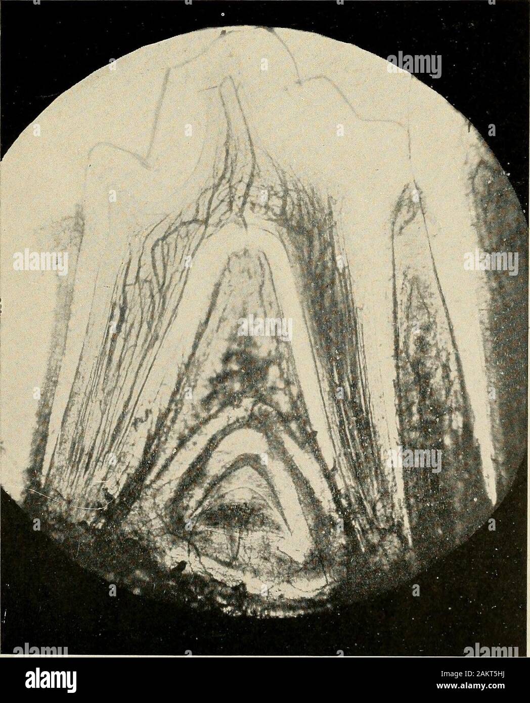 Section of a molar hi-res stock photography and images - Alamy