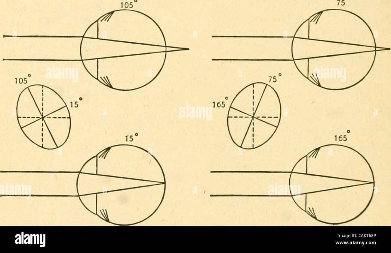 Astigmatism drawing hi-res stock photography and images - Alamy