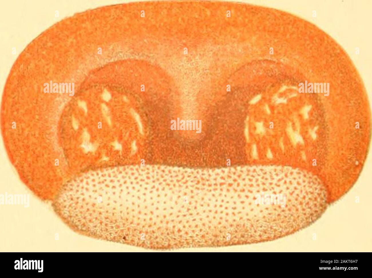 Glandular fever hi-res stock photography and images - Alamy