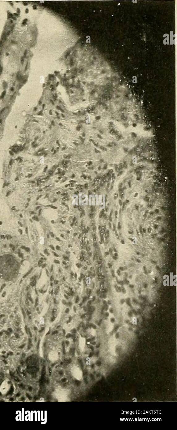 Odontoblastic layer hi-res stock photography and images - Alamy