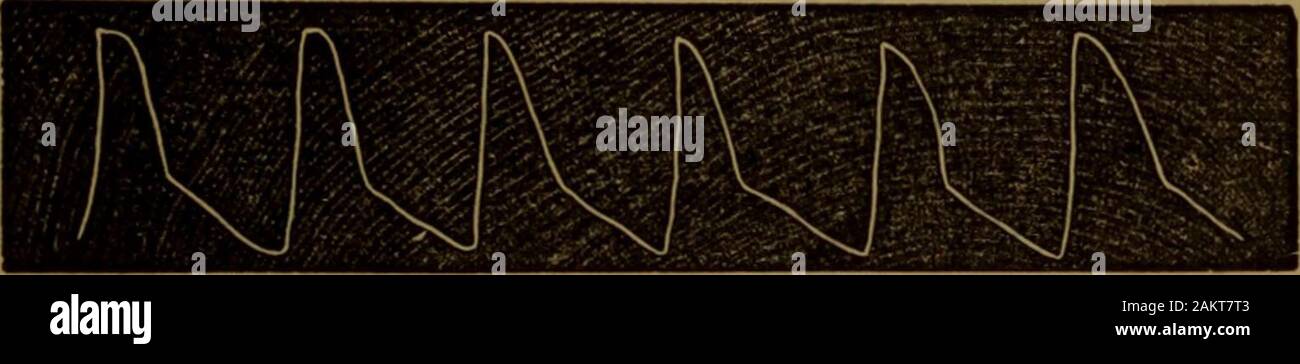 The sphygmograph and the physiology of the circulation : a monograph ...