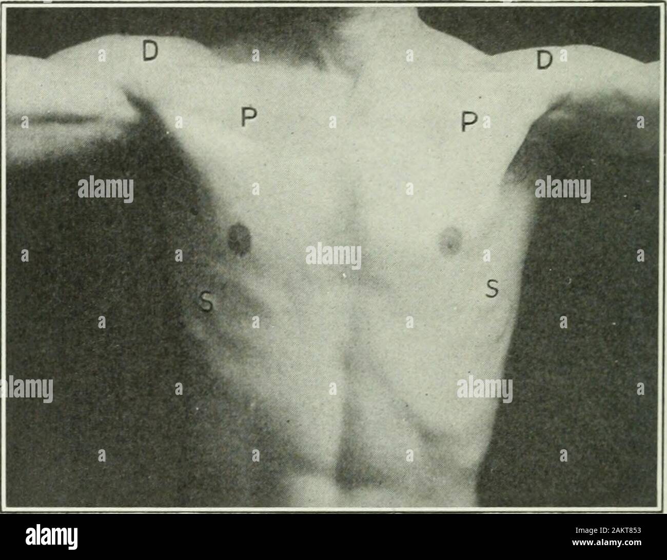 Raised right upper arm hi-res stock photography and images - Alamy