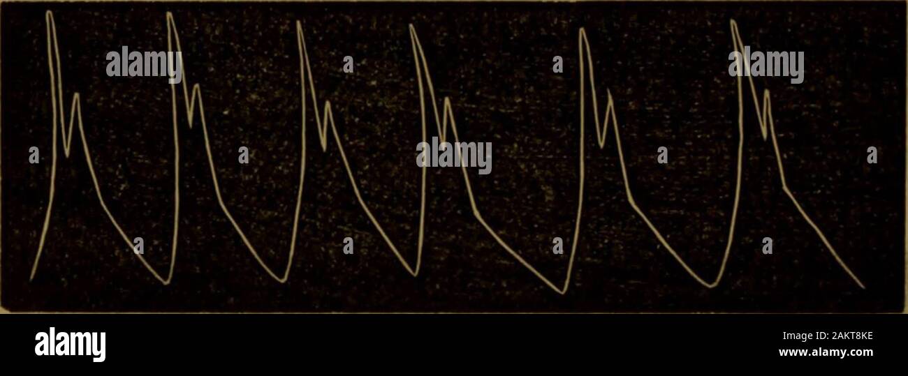 The sphygmograph and the physiology of the circulation : a monograph ...
