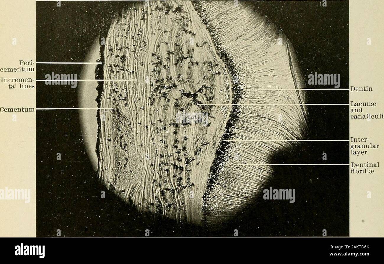 Principles and practice of operative dentistry . Kerve Fig, 175 ...