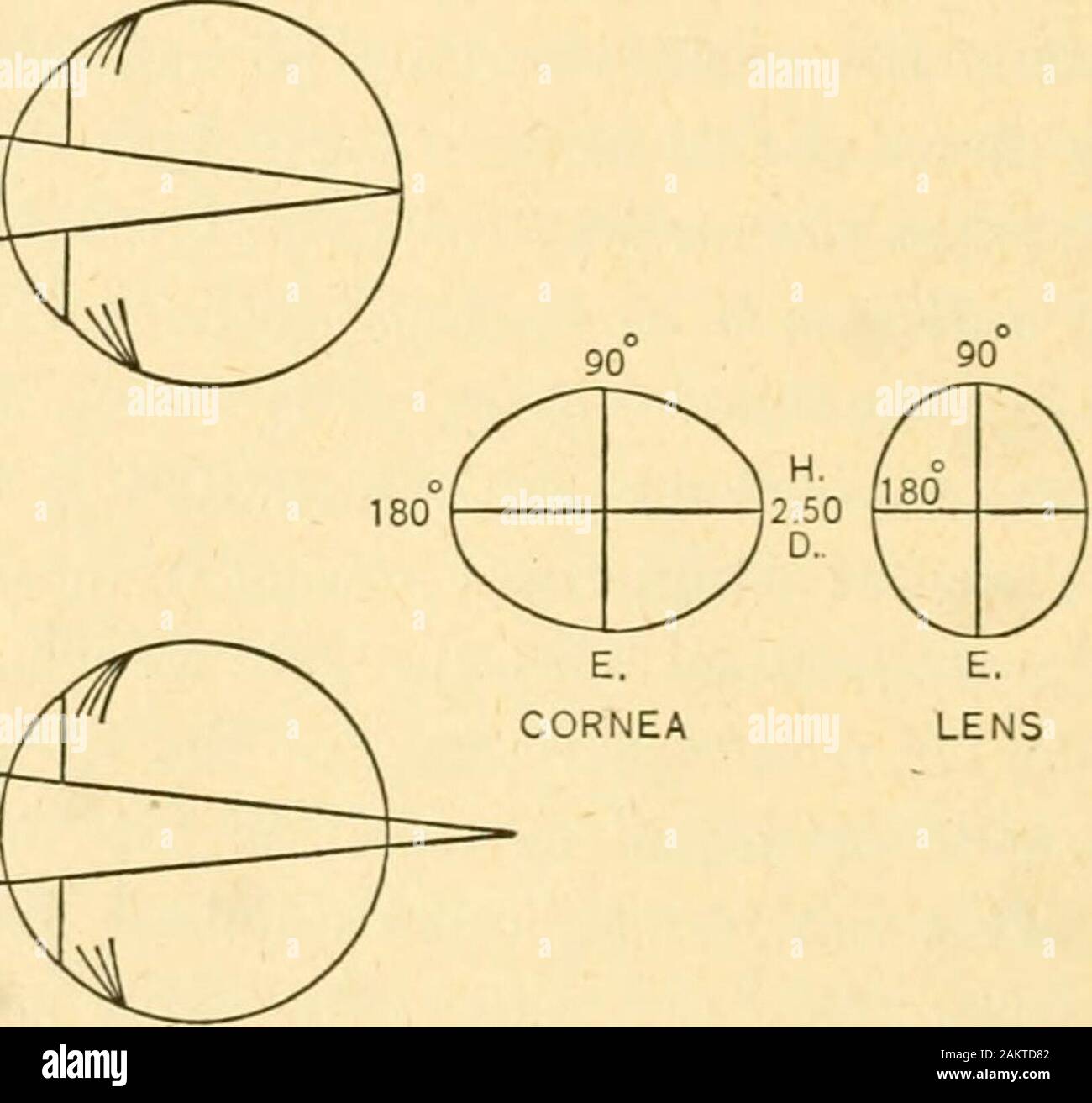 The refraction of the eye; including a complete treatise on ...