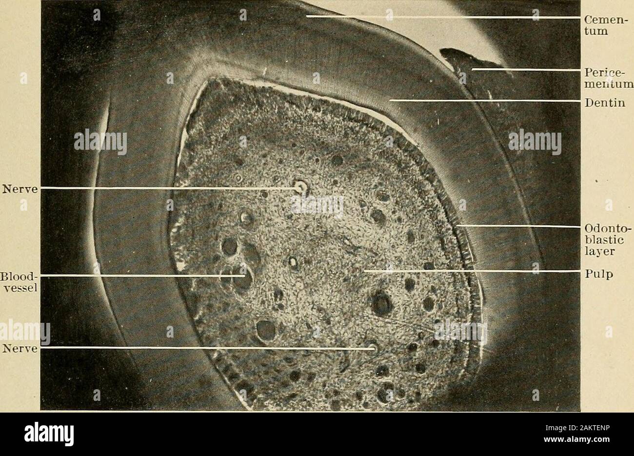 Decalcified bone hi-res stock photography and images - Alamy