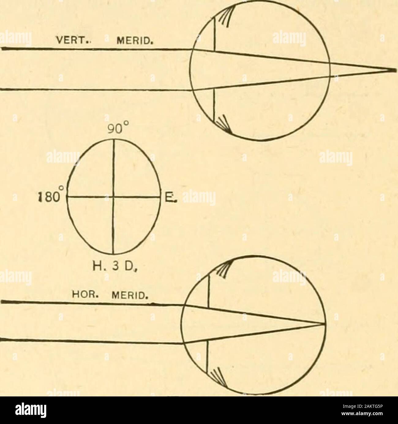 The refraction of the eye; including a complete treatise on ...
