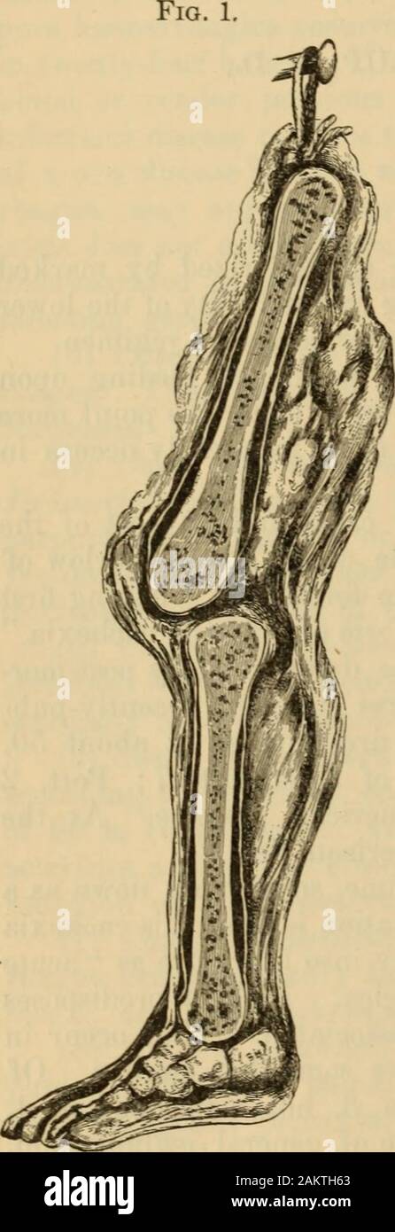 Grumous hi-res stock photography and images - Alamy