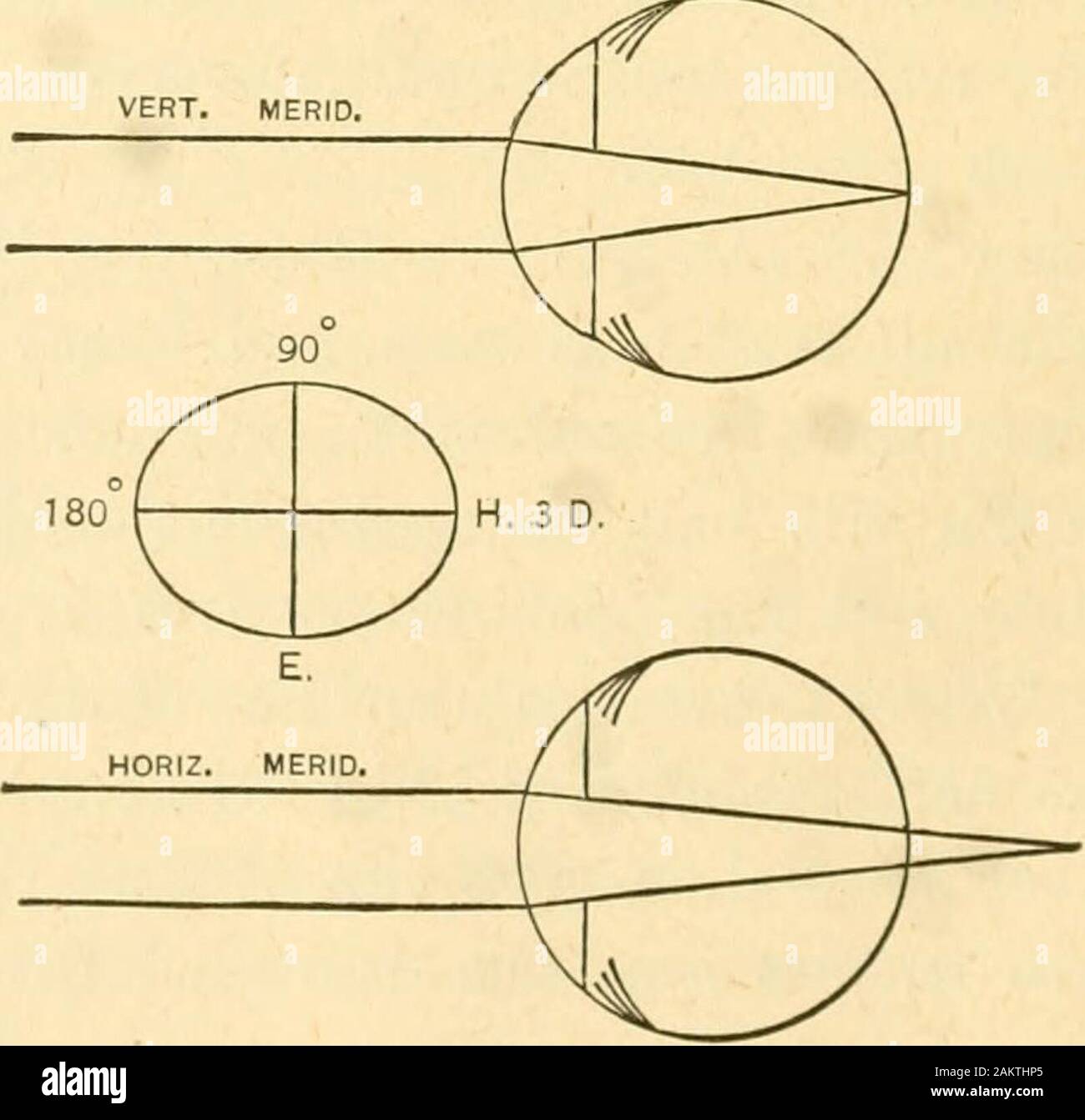Hypermetropic High Resolution Stock Photography and Images - Alamy