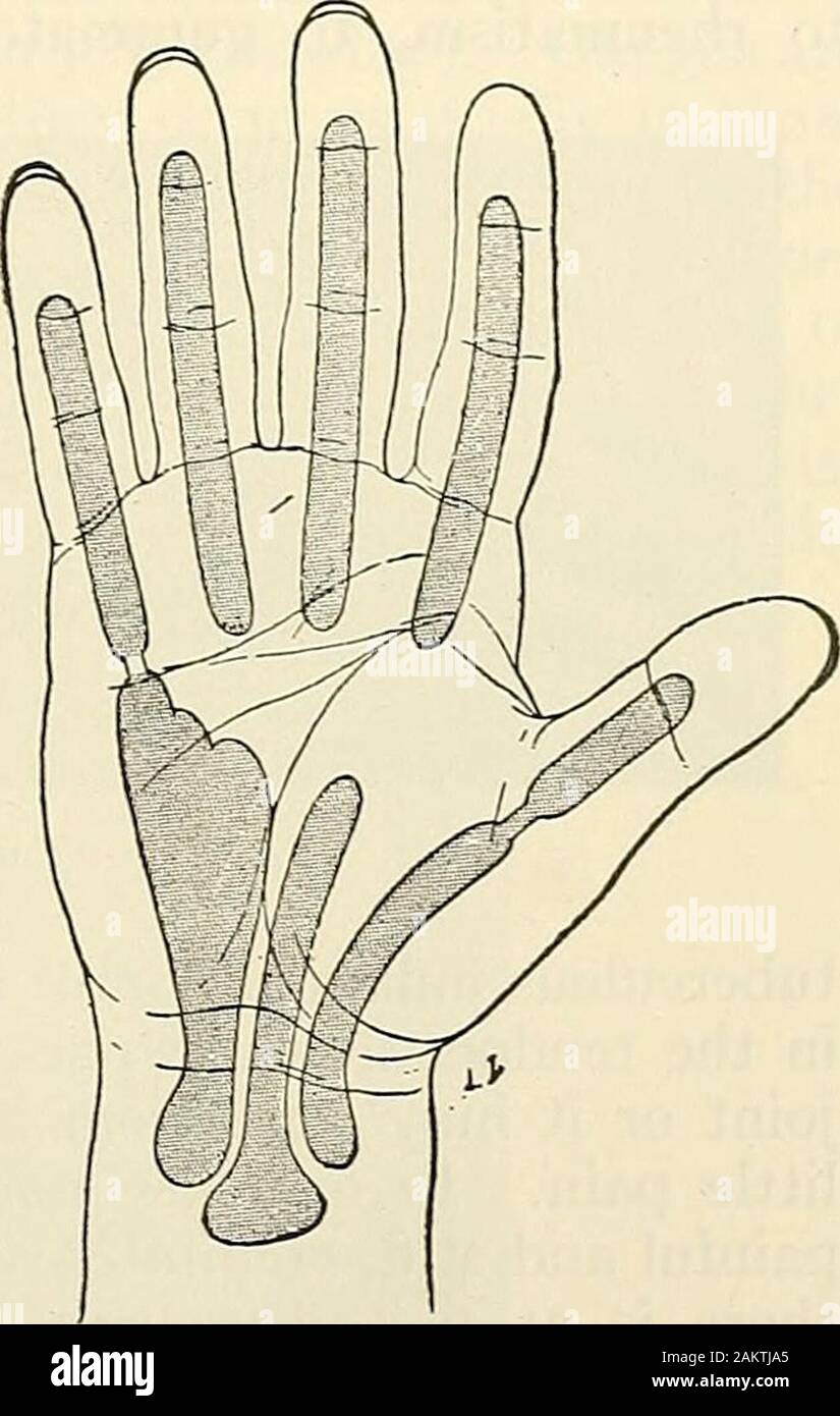 Thecal hi-res stock photography and images - Alamy