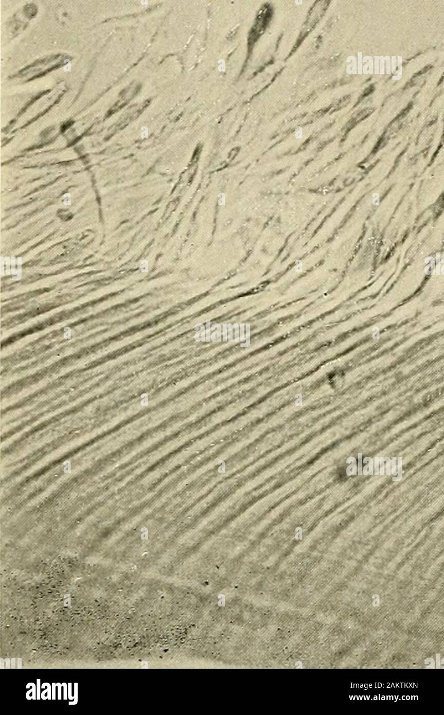 Principles and practice of operative dentistry . Inversion ofportion ...