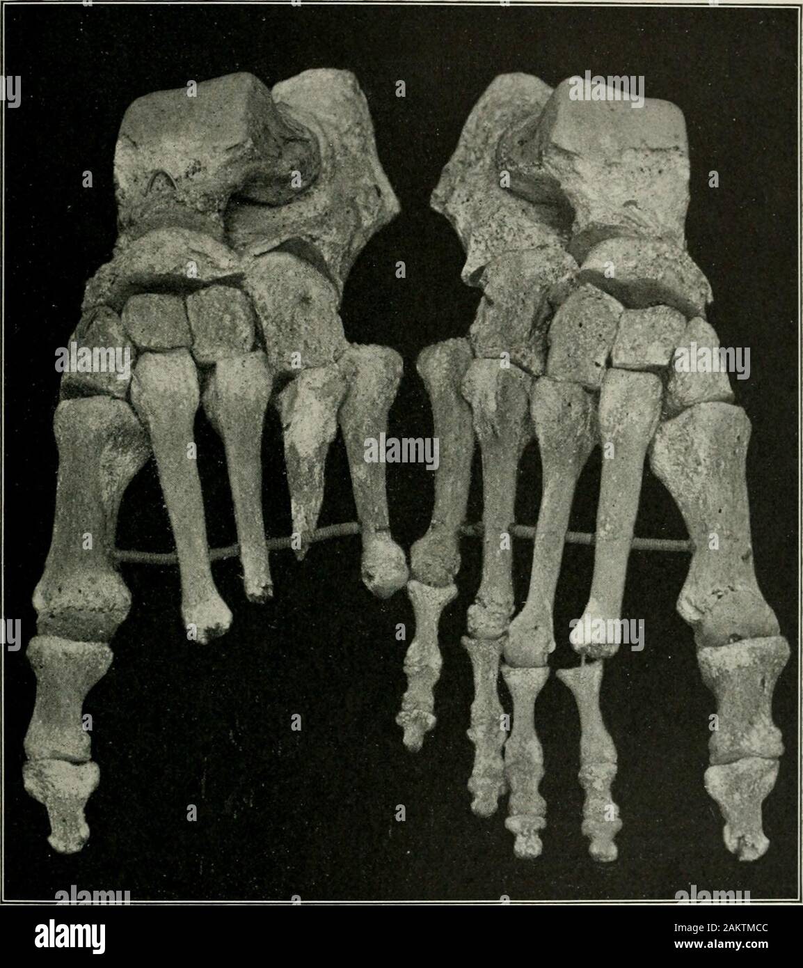 Gummata hi-res stock photography and images - Alamy