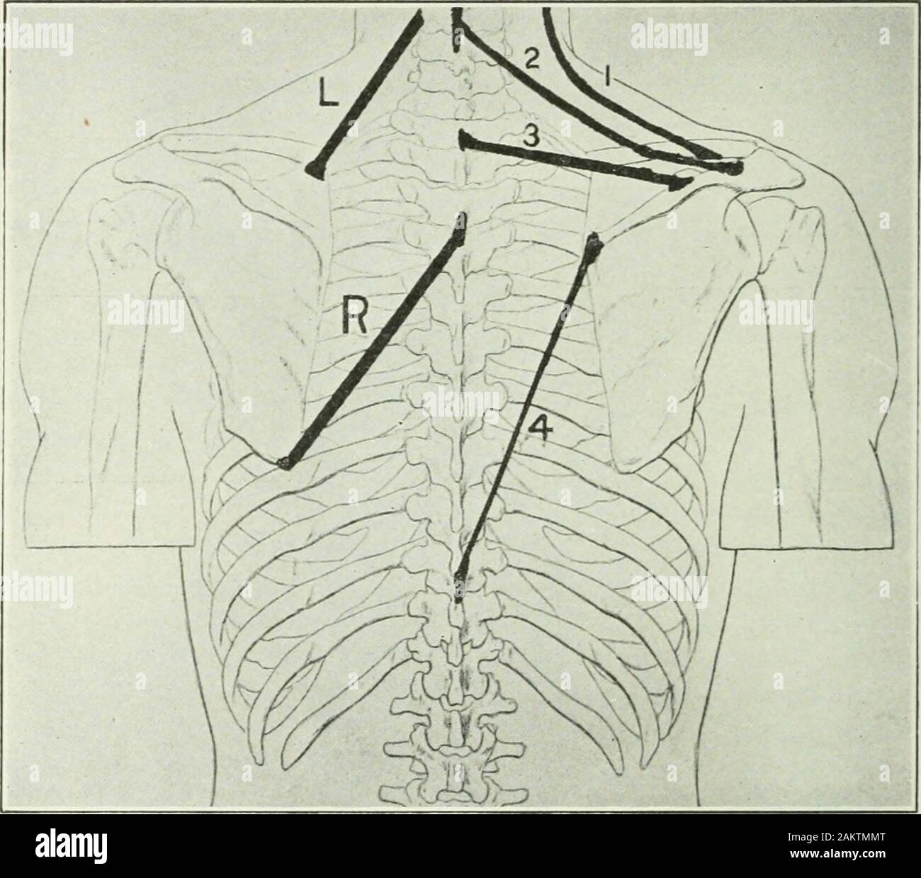Left shoulder anatomy hi-res stock photography and images - Alamy