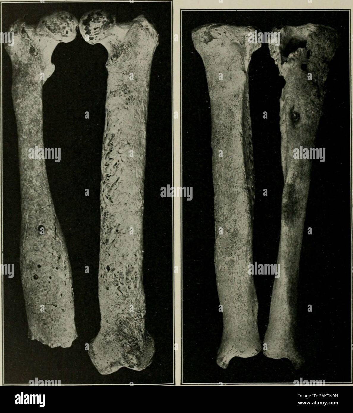 American practice of surgery : a complete system of the science and art ...