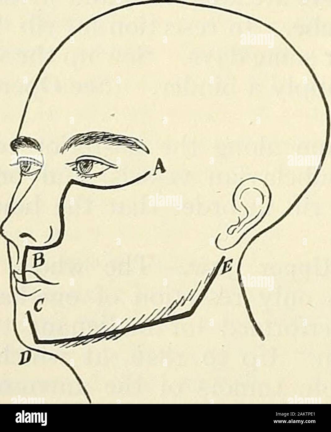 Modern surgery, general and operative . d bleedingpoints are ligated ...