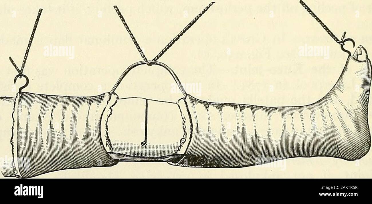 Modern surgery, general and operative . etentionprevents displacement ...