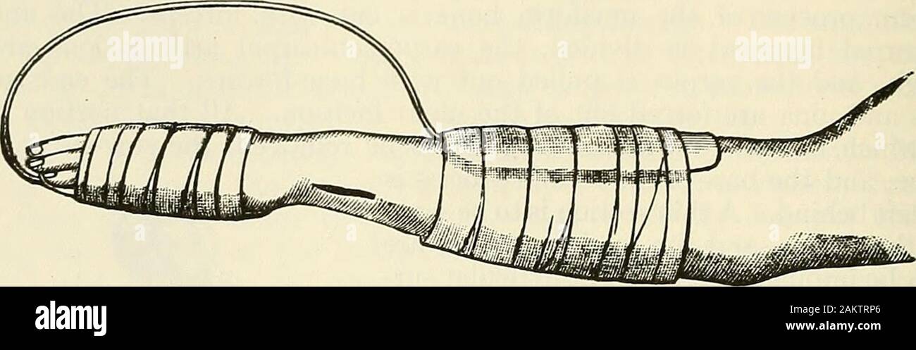 Radial incision hi-res stock photography and images - Alamy
