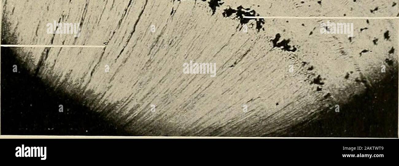 Principles and practice of operative dentistry . Lacunae I Cementum ...