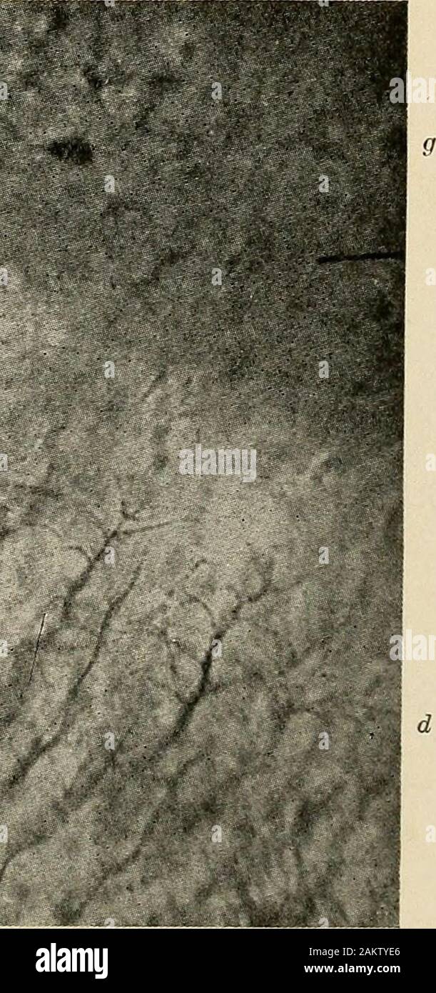 Silver nitrate method hi-res stock photography and images - Alamy