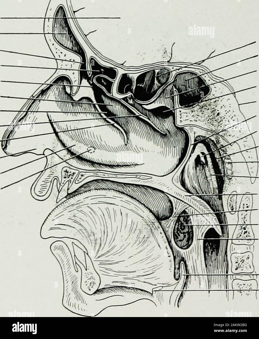 War surgery of the faceA treatise on plastic restoration after facial ...