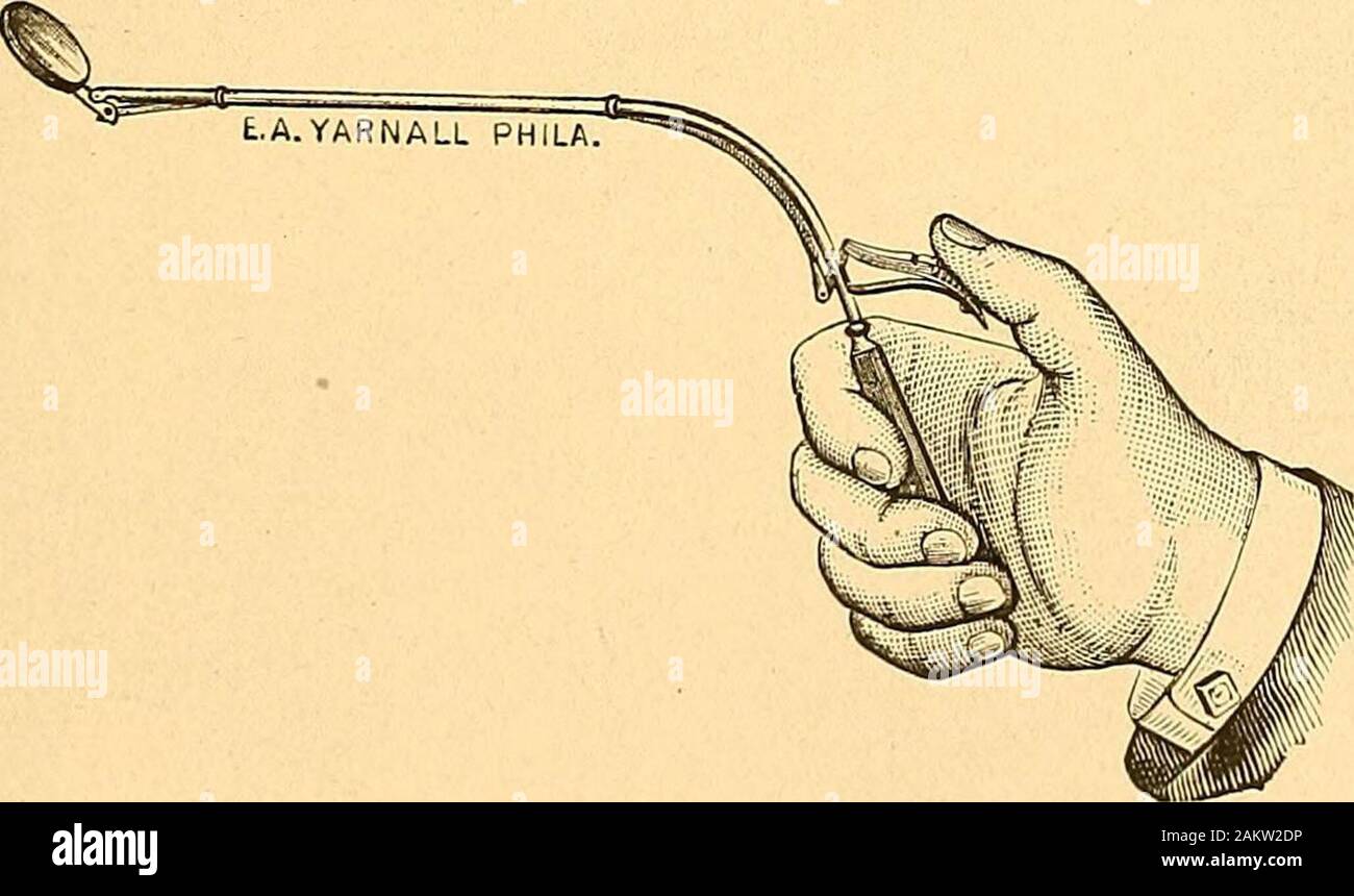 Rhinoscopy hi-res stock photography and images - Alamy