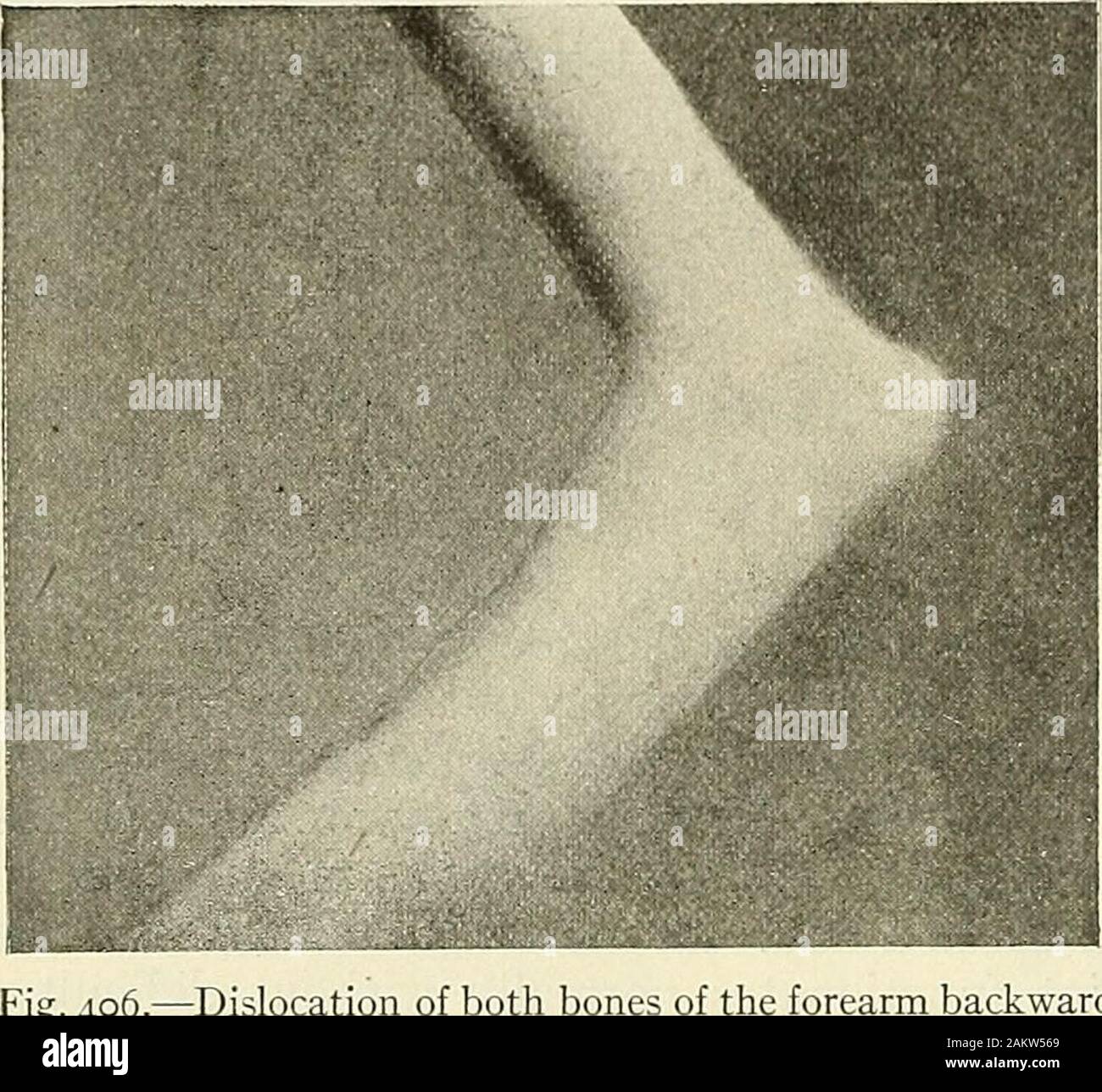 Modern surgery, general and operative . xposed through the usual ...