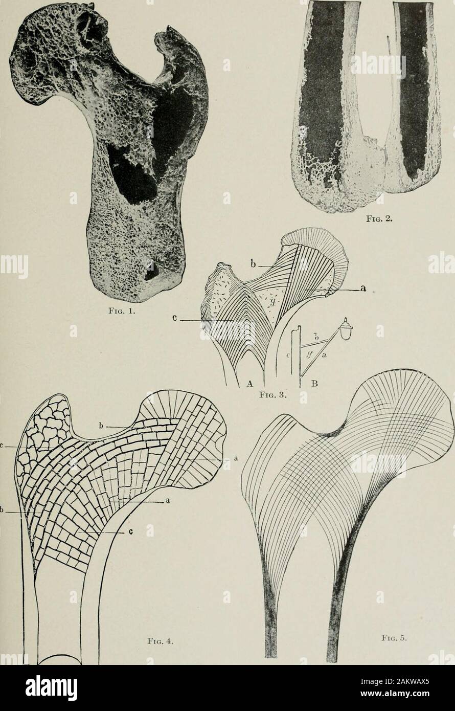 Leg amputation stump hi-res stock photography and images - Alamy
