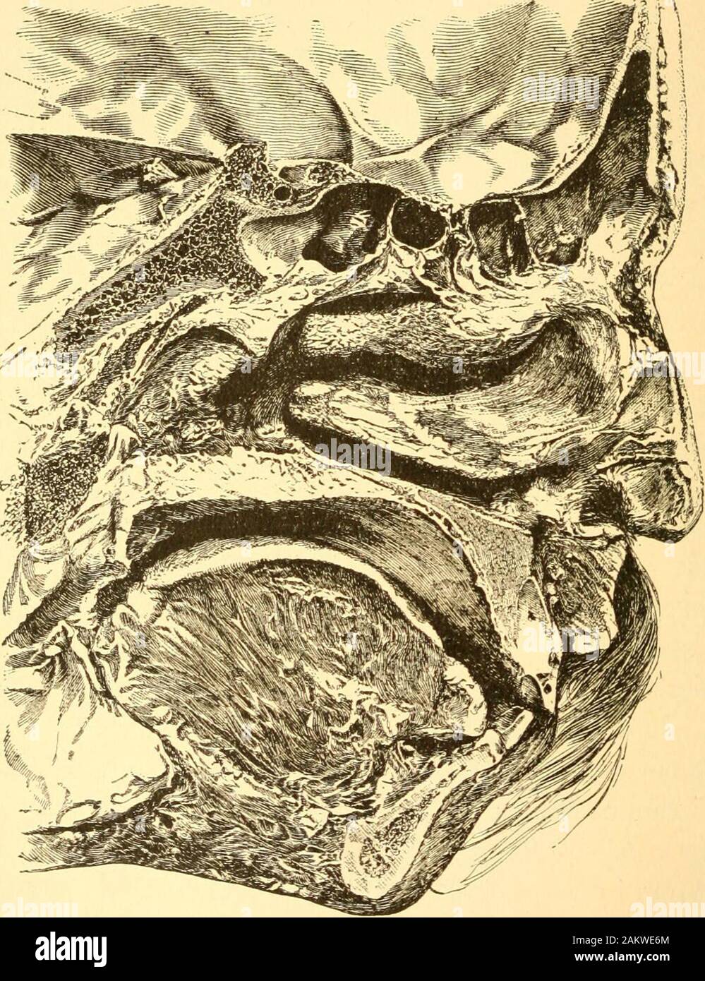Cribriform plate hi-res stock photography and images - Alamy