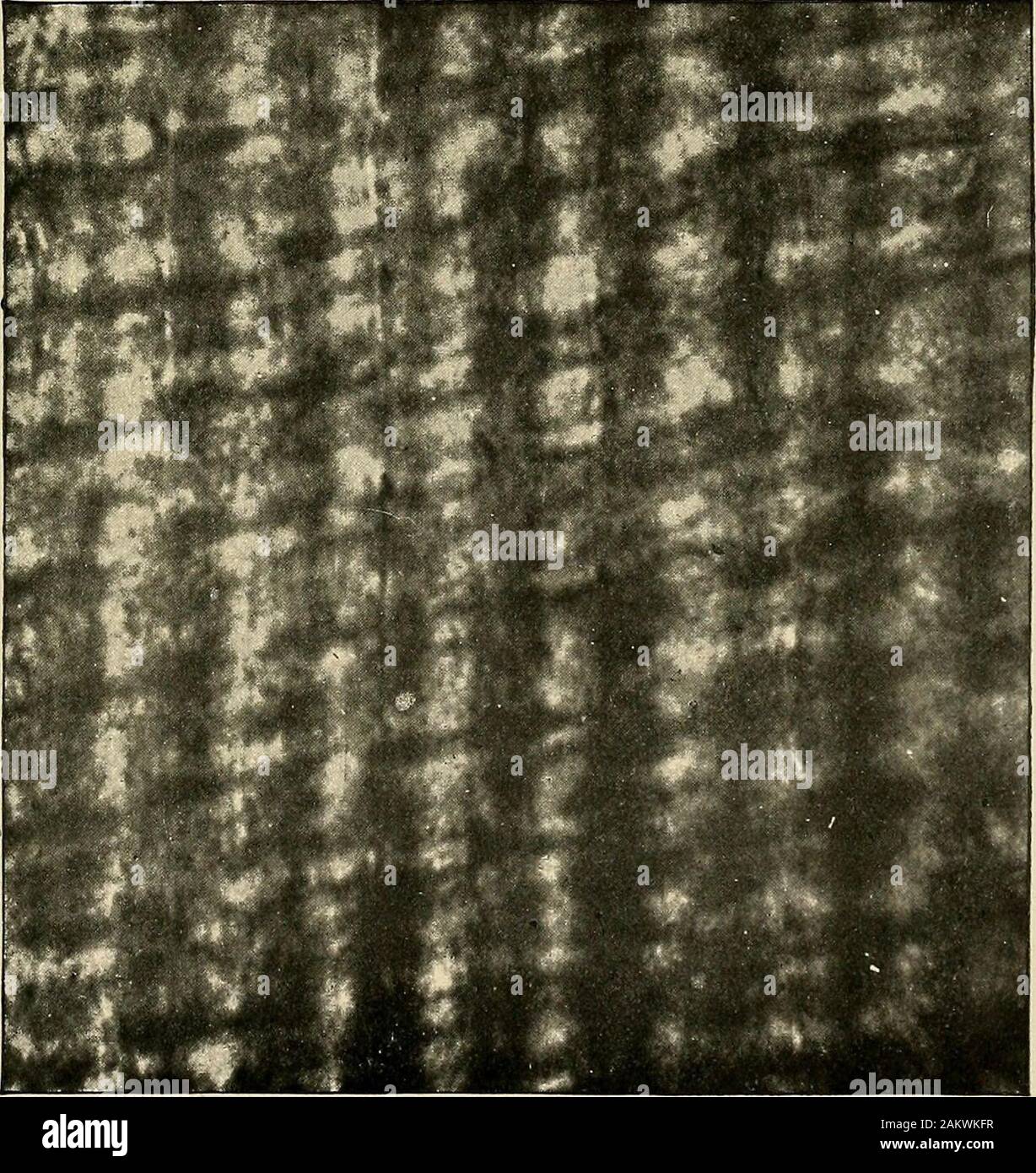 Enamel rods hi-res stock photography and images - Alamy