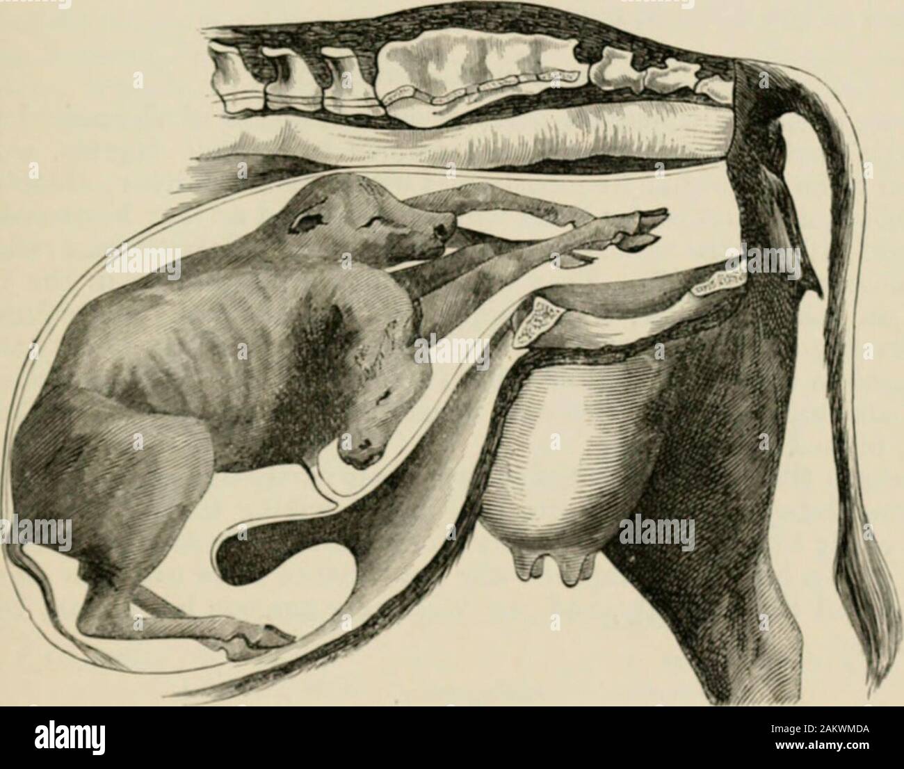 Birth deformed hi-res stock photography and images - Alamy
