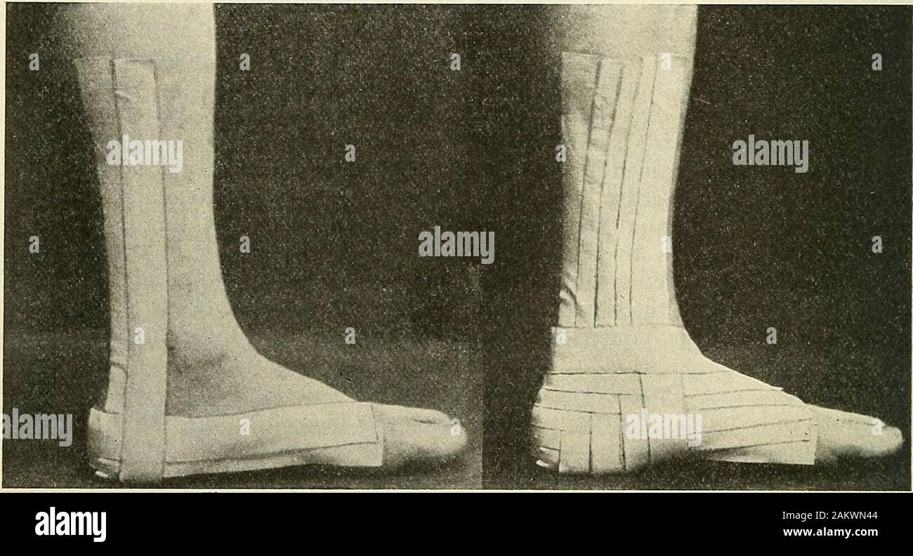 Liniments hi-res stock photography and images - Alamy