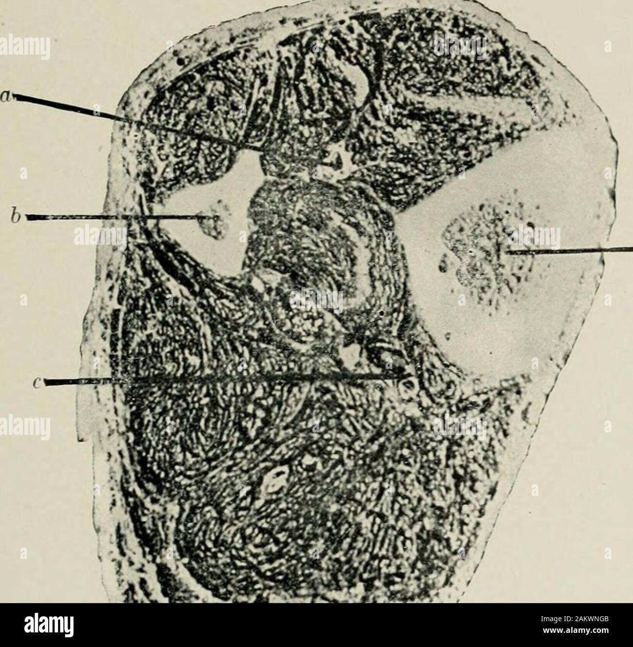 Non operative hi-res stock photography and images - Alamy