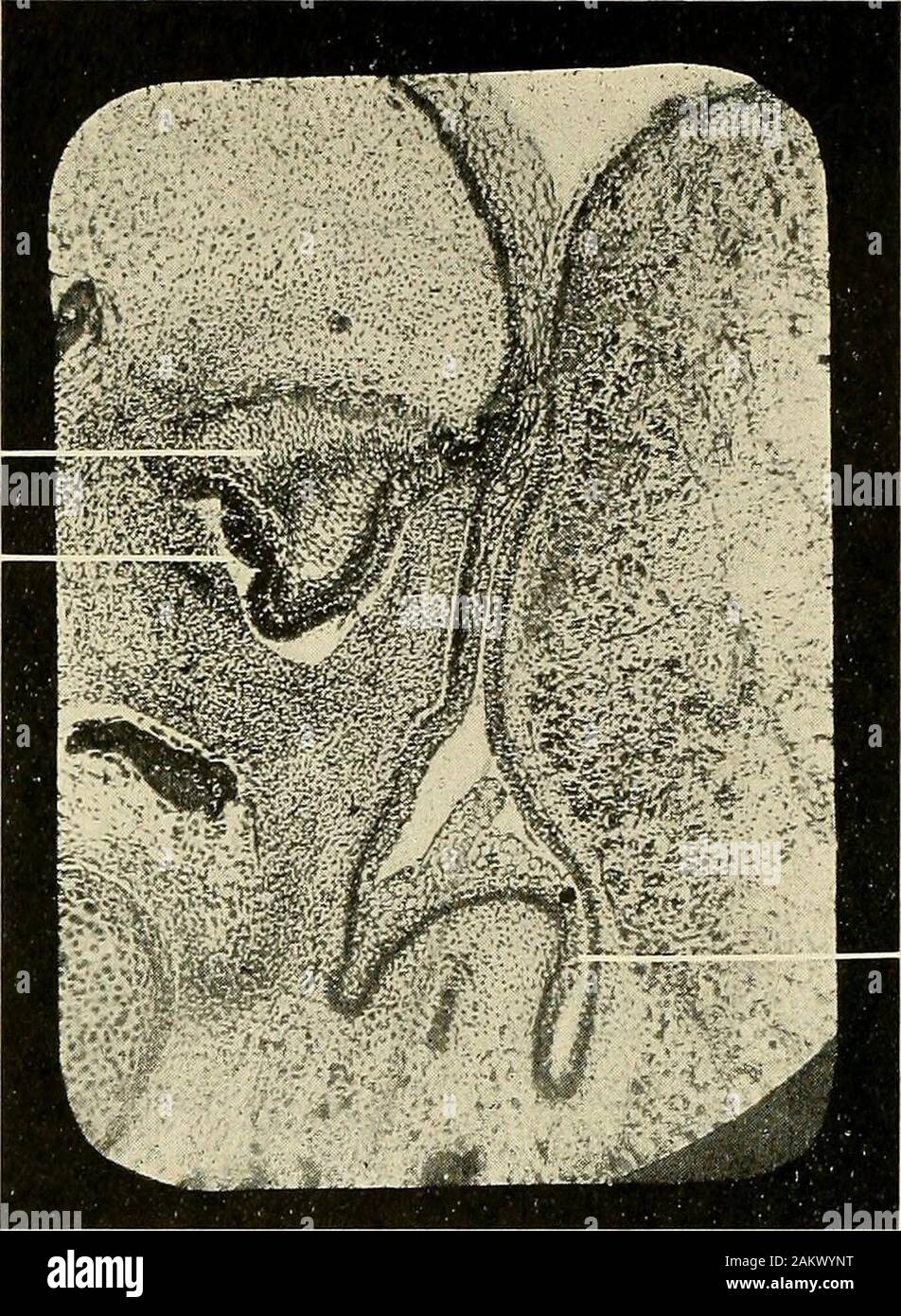 Principles and practice of operative dentistry . Primitiveefiithelial ...