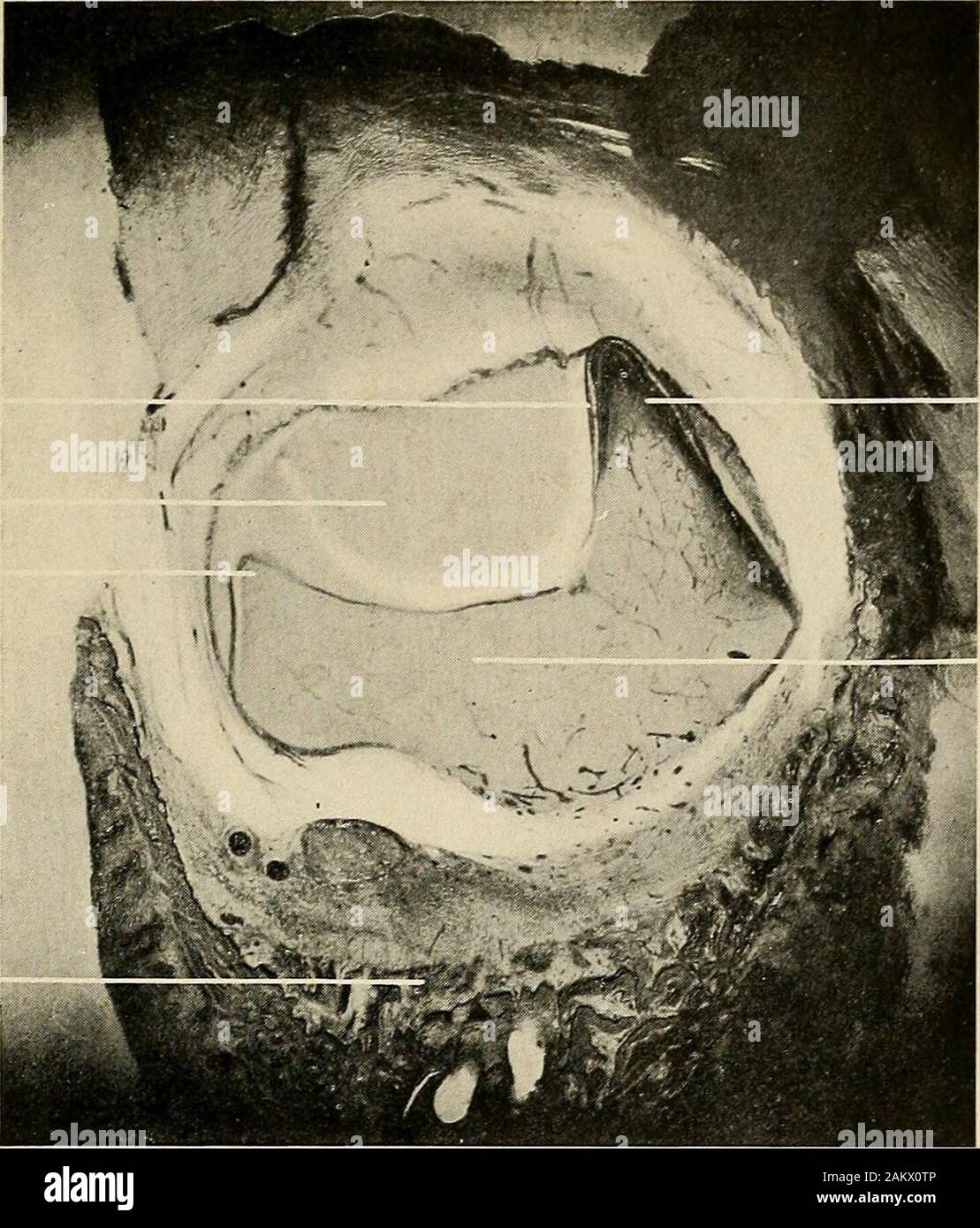Stellate cells hi-res stock photography and images - Alamy