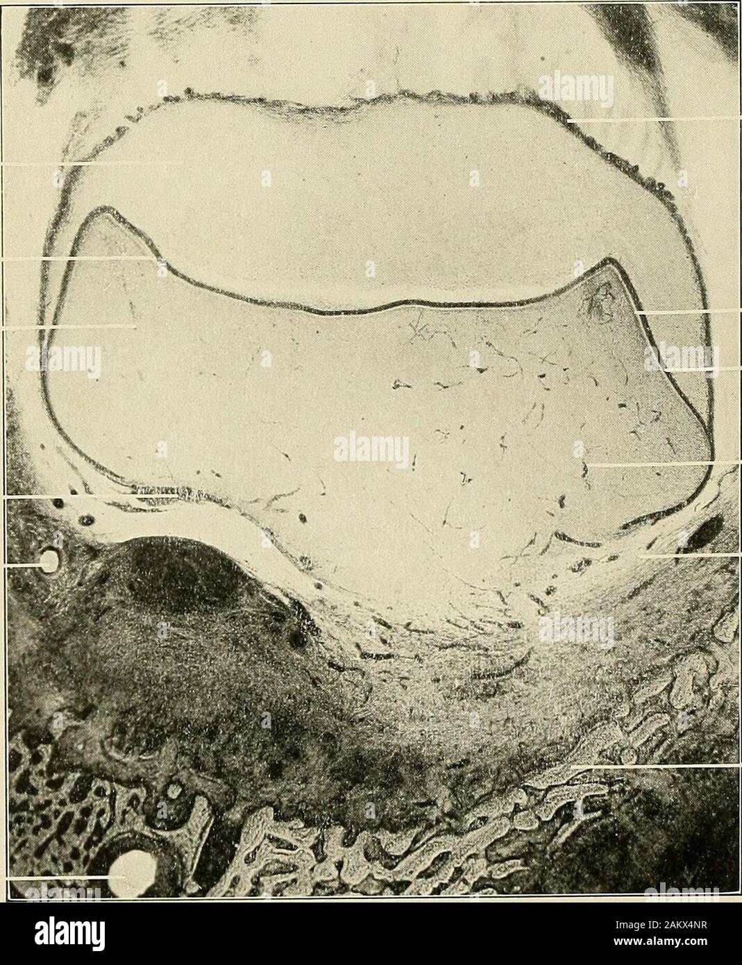 Principles and practice of operative dentistry . Fig. 112.—Developing ...