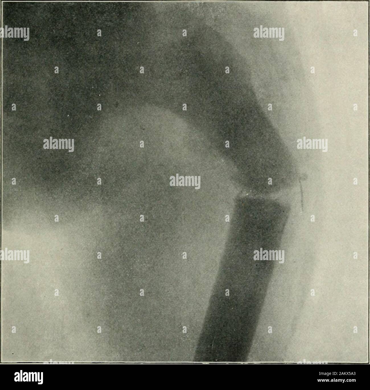 Ease Of Manipulation High Resolution Stock Photography and Images - Alamy