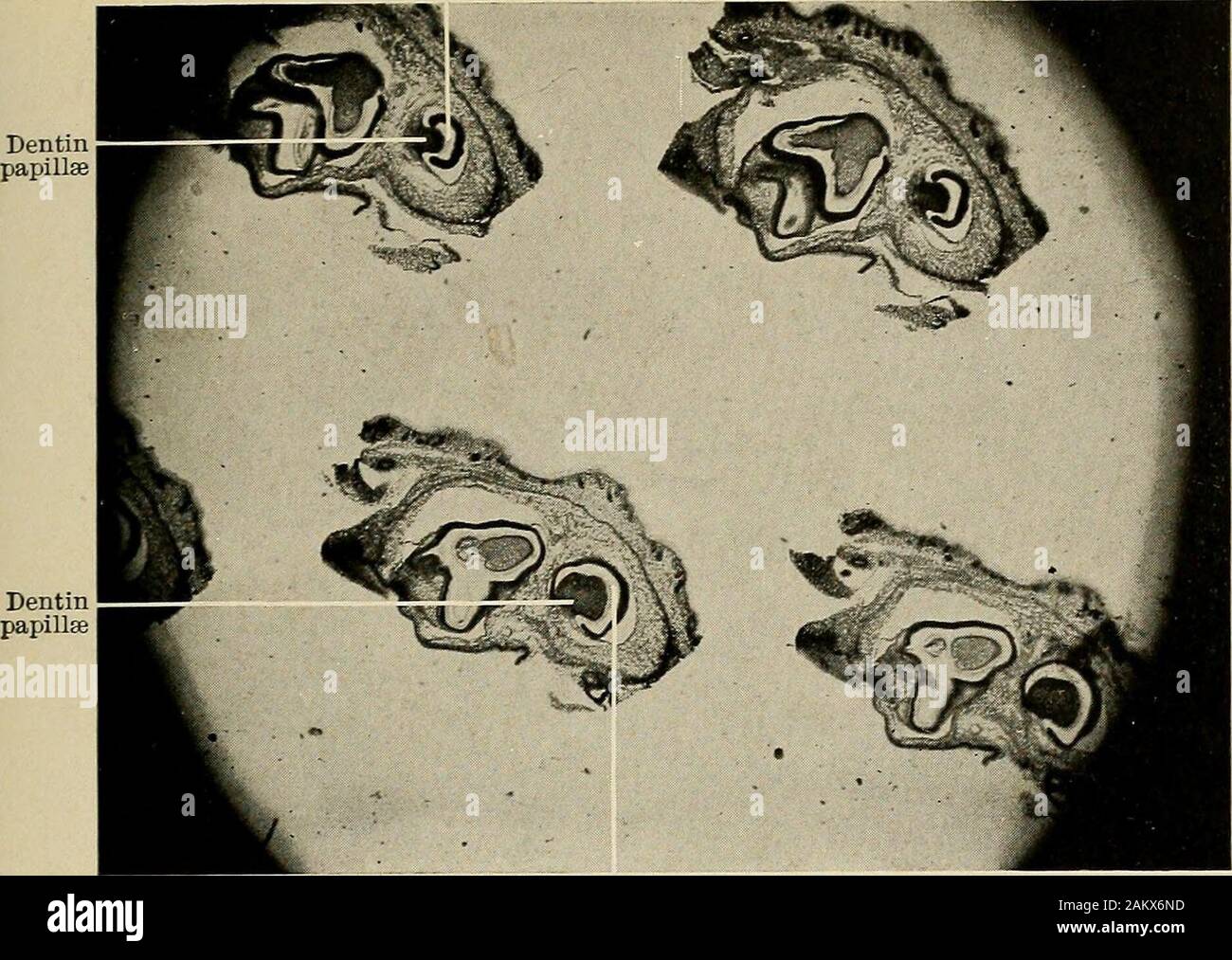 Principles and practice of operative dentistry . Fig. 109.—Primitive ...