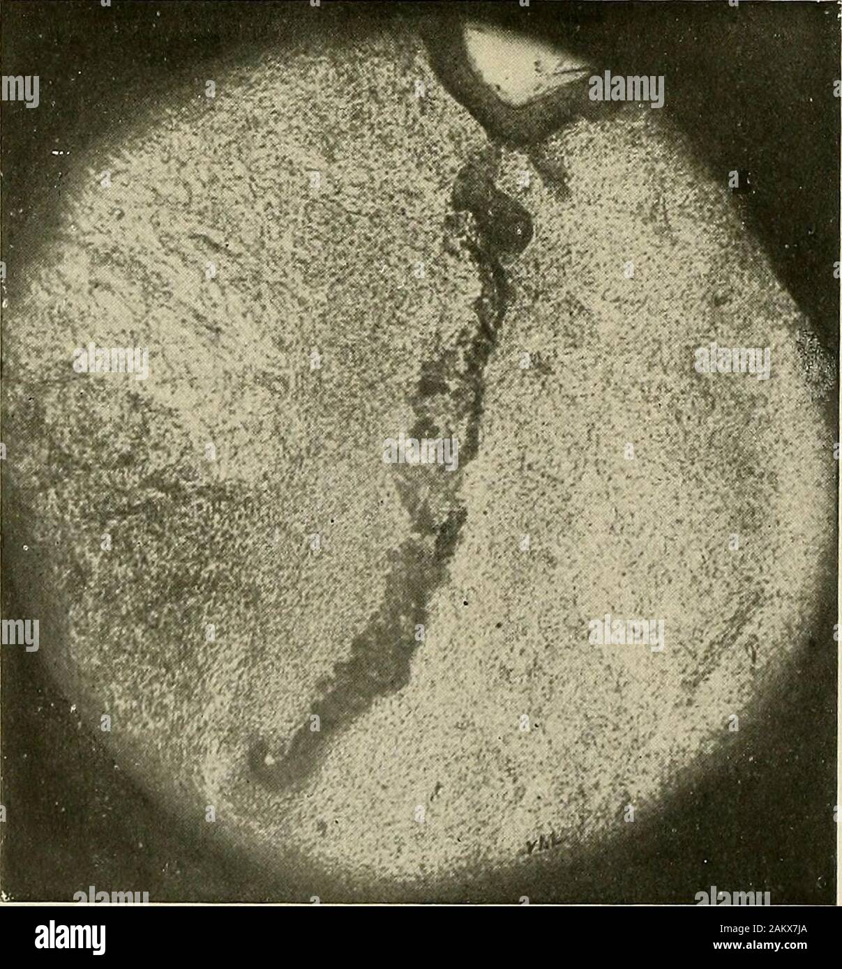 Principles and practice of operative dentistry . Fig. 108.—Crosa-s ...
