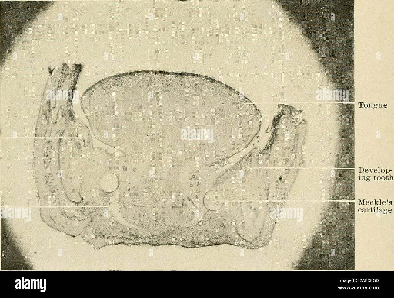 Principles and practice of operative dentistry . Fig. 103.—Vertical ...