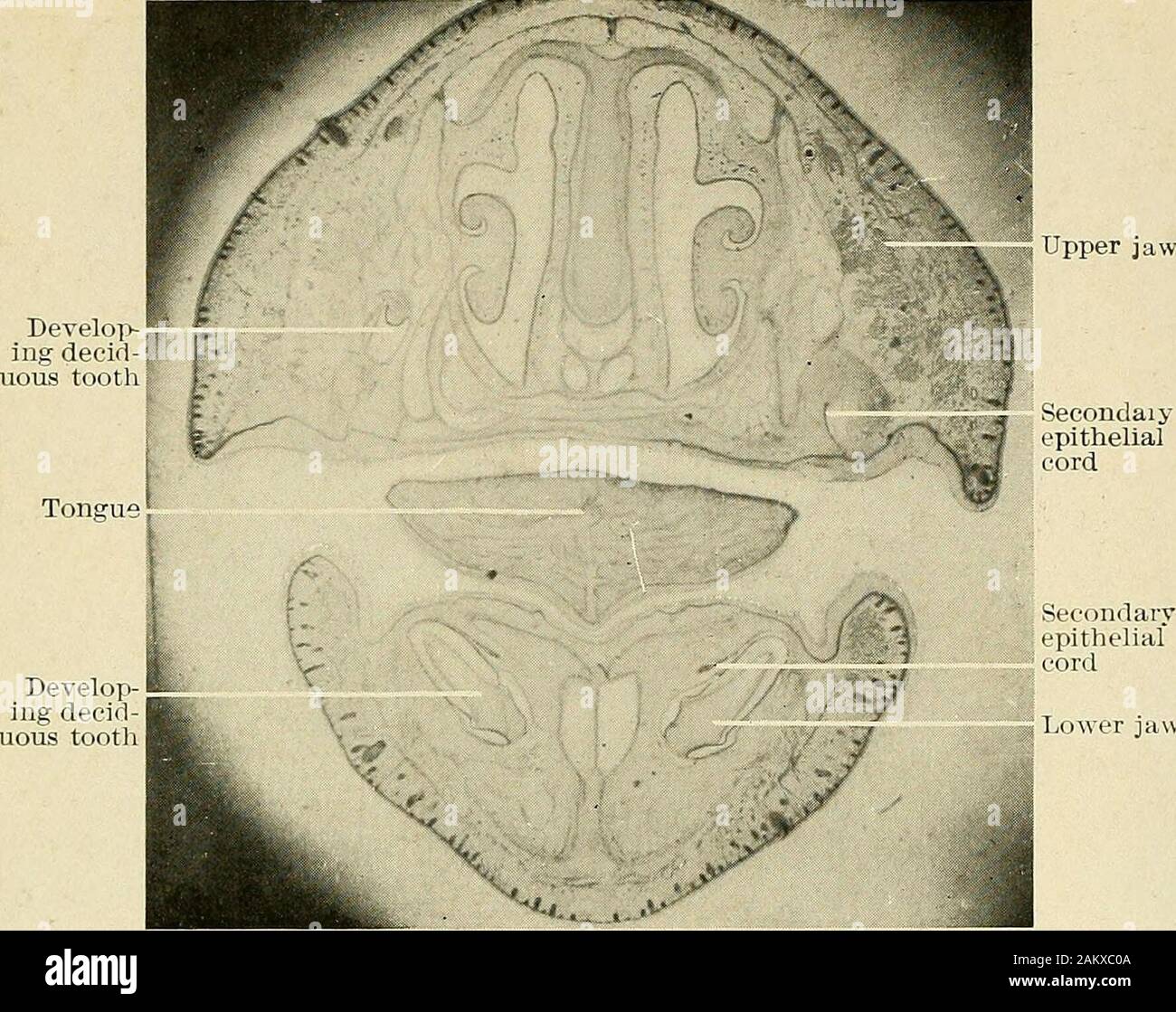 Bone hairs hi-res stock photography and images - Alamy