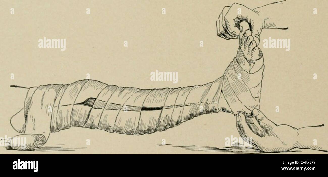 American practice of surgery : a complete system of the science and art ...