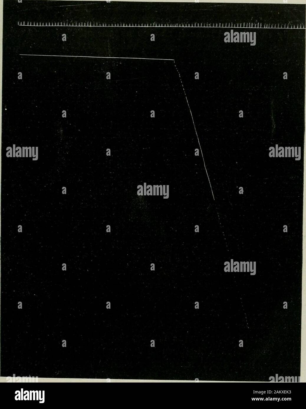 Brain arterial venous hi-res stock photography and images - Alamy