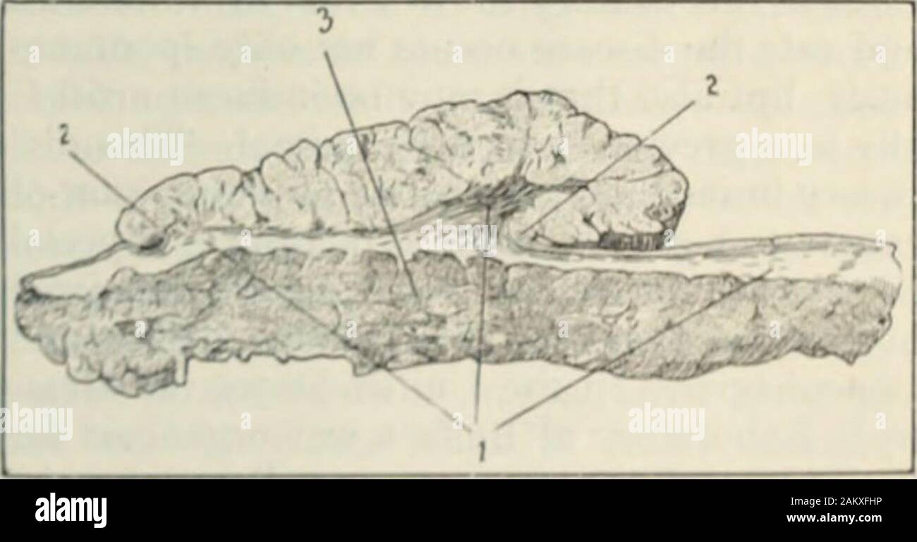 Marvelous inventions hi-res stock photography and images - Alamy