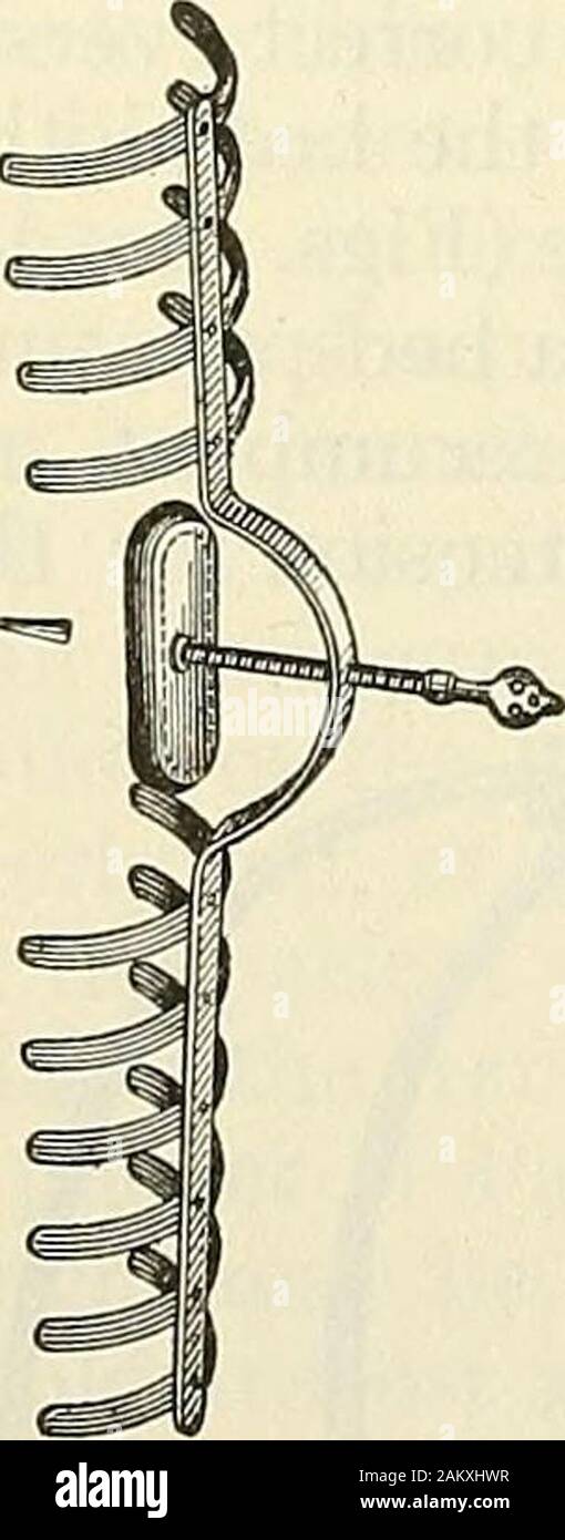 Femoral neck fractures hi-res stock photography and images - Alamy