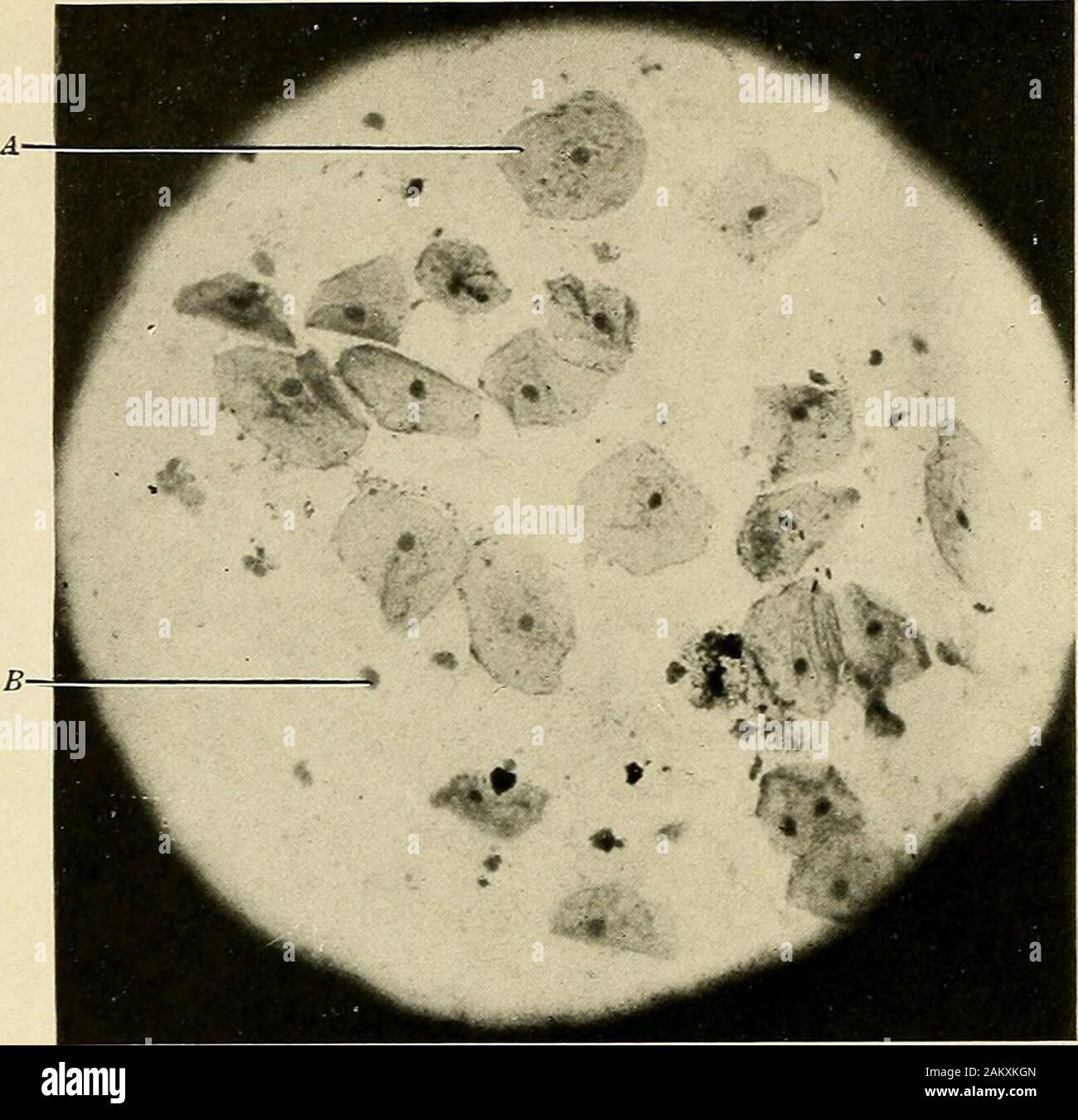 Principles and practice of operative dentistry . Cuticle Fig. 90 ...