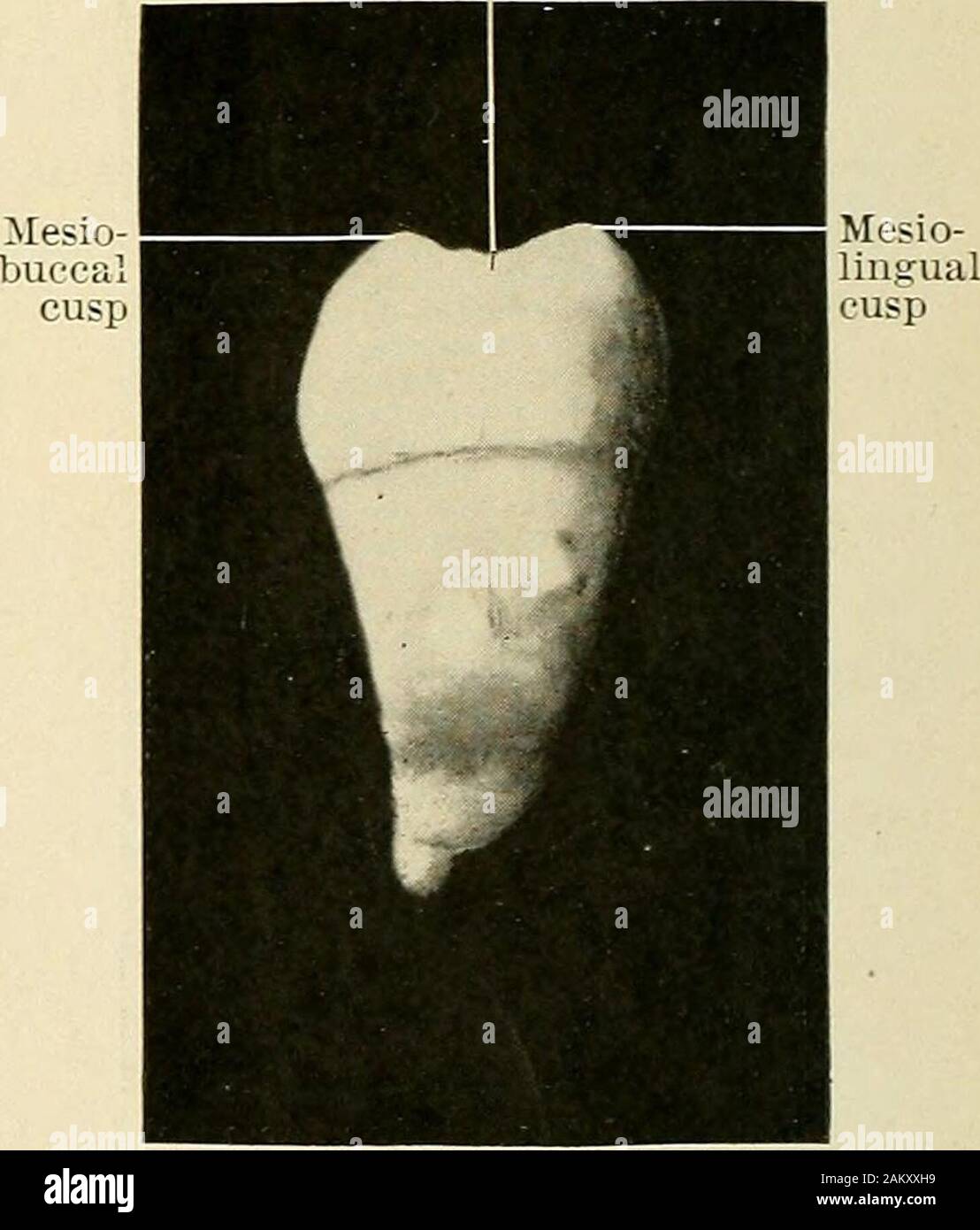 Principles and practice of operative dentistry . Fig. 79.—Inferior ...
