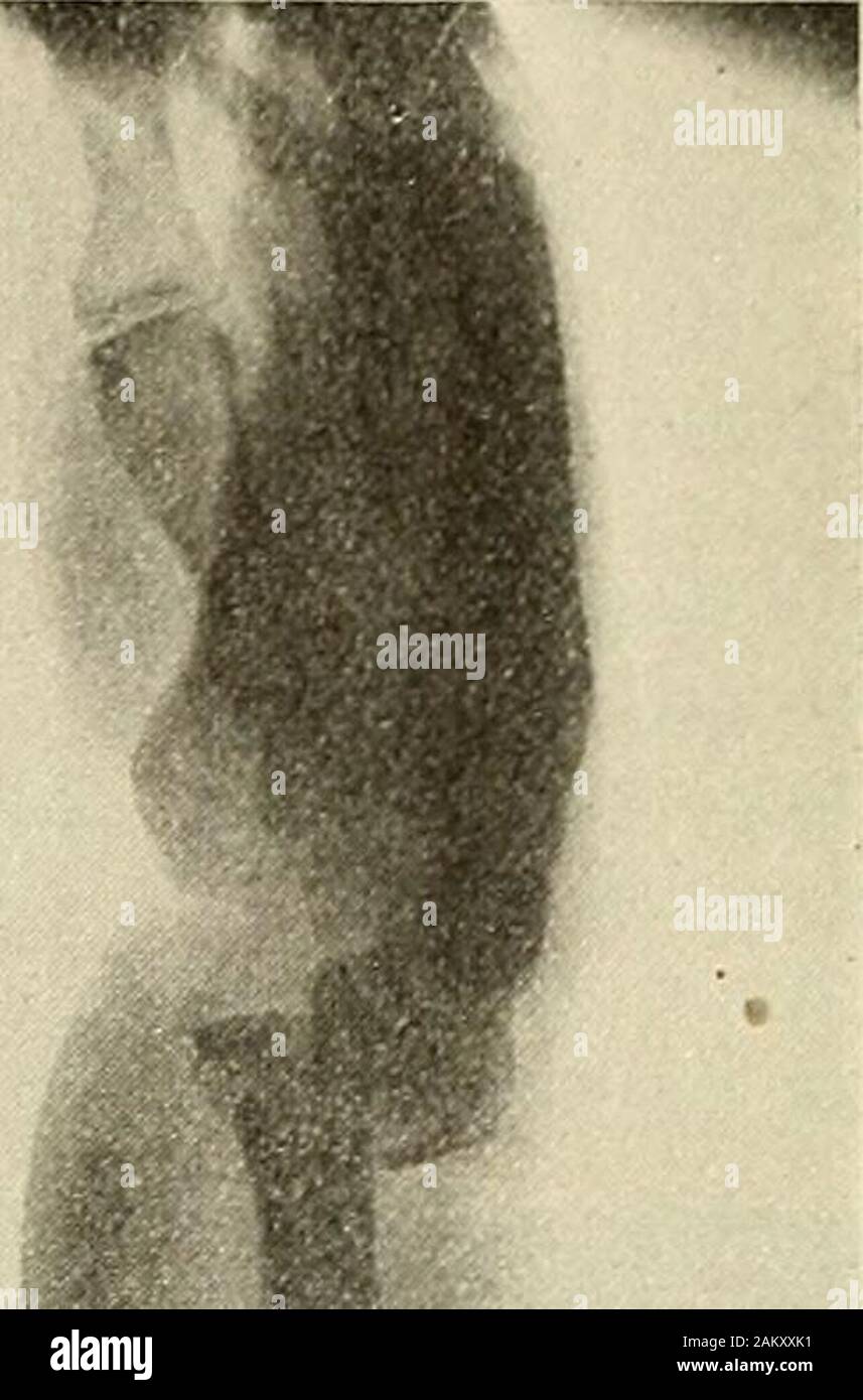 Modern surgery general operative hi-res stock photography and images ...